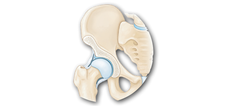 Direct Anterior Hip Replacement | CNOS, PC